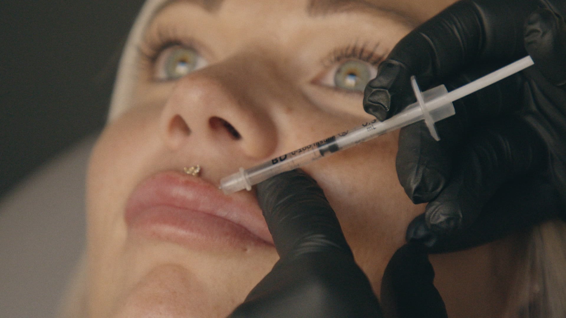 Injections et bistouris | S2:E2 | Êtes-vous bien informée? | Noovo